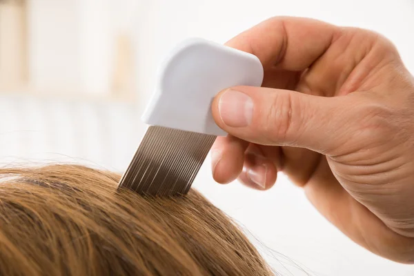 Lice Prevention Tips and Treatment Options from a Dermatologist